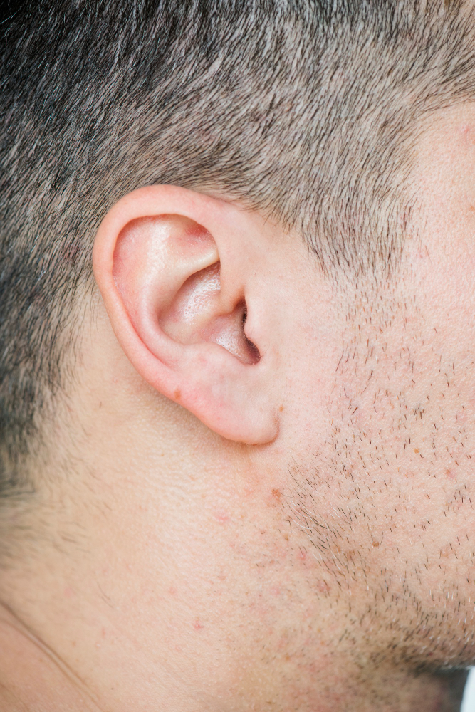Earlobe Repair – Dermaura Skin Care Clinic
